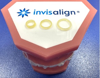 Elastics for Invisalign | Invisalign Price In Singapore - MyBracesClinic