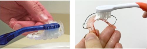 Retainer Instructions | Retainer Singapore - MyBracesClinic