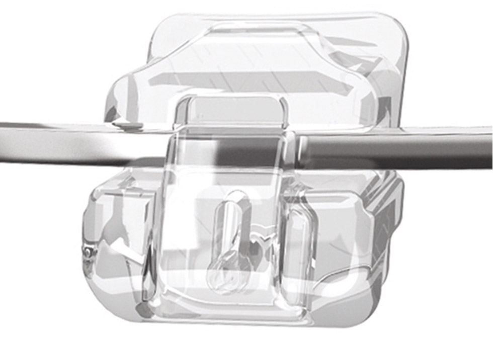 Damon Clear Ceramic Braces - MyBracesClinic