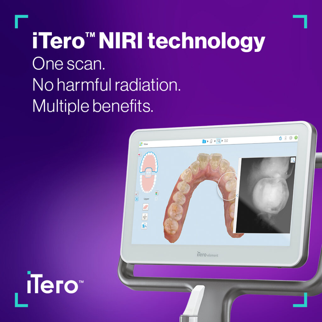 iTero 口内扫描 - MyBracesClinic