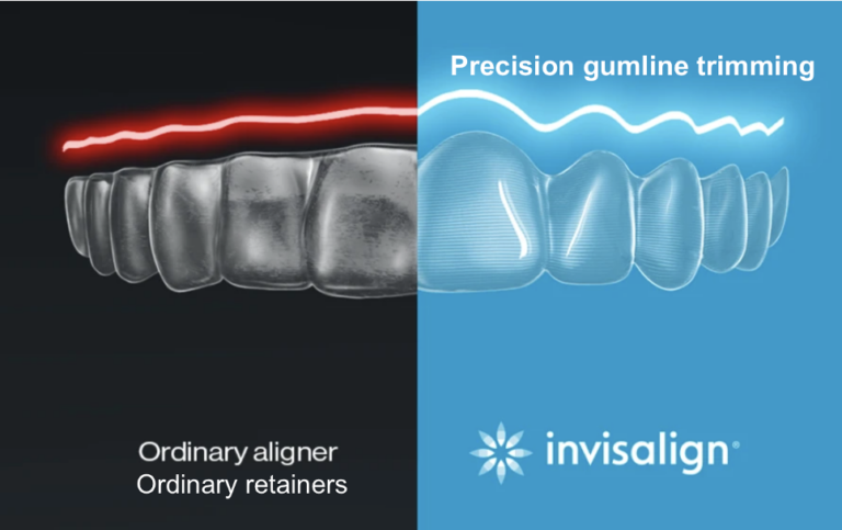 Types of Orthodontic Retainers | Retainer Singapore - MyBracesClinic