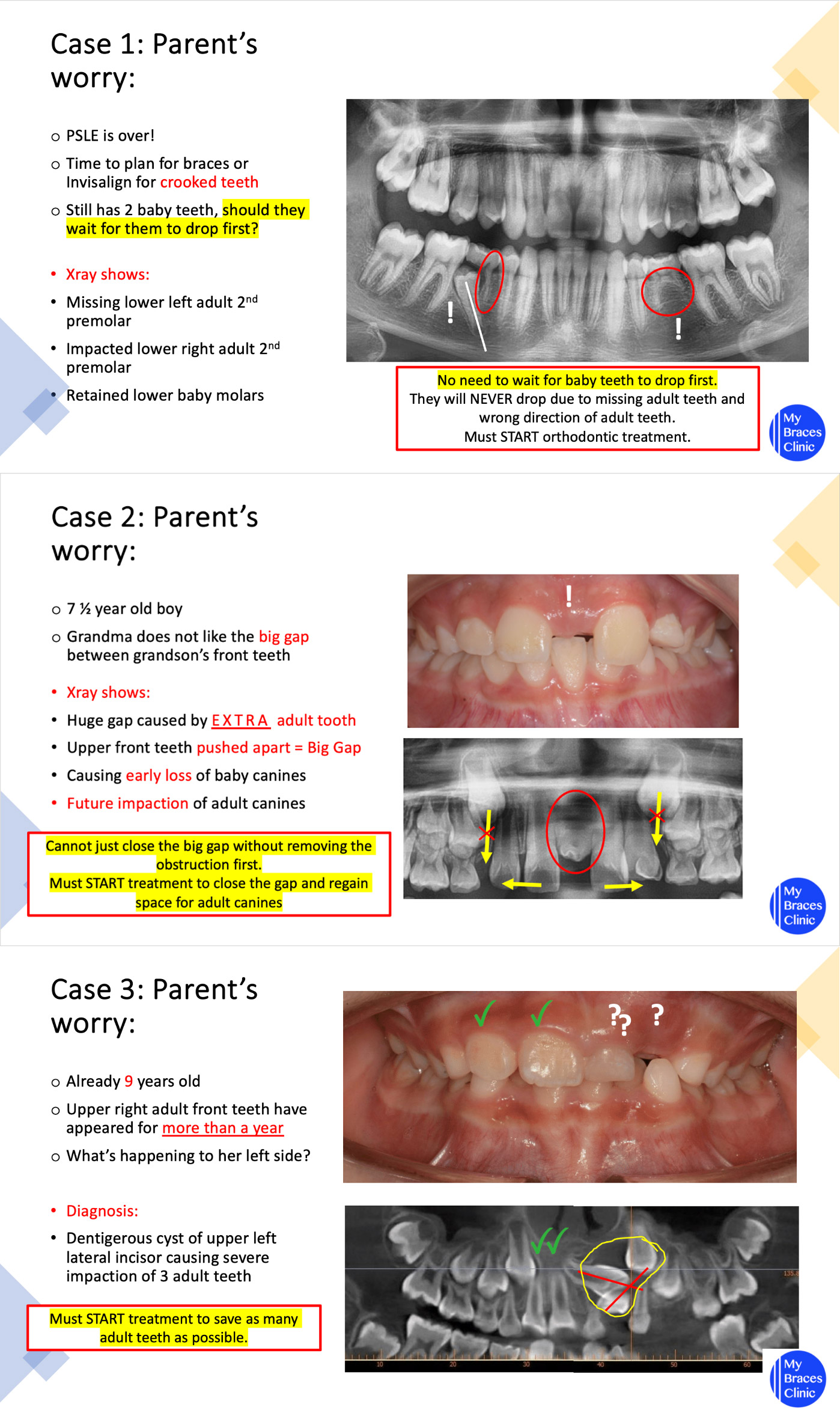 Digital Xray | Diagnosis - MyBracesClinic