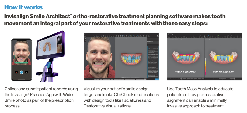 Invisalign Smile Architect | Invisalign In Singapore - MyBracesClinic