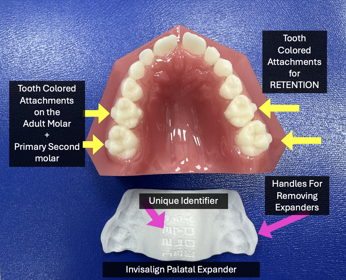 Invisalign Palatal Expander | Invisalign In Singapore - A Complete Guide
